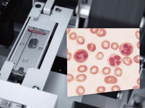 Blood-Smear Microscope Slides - Buy blood smear microscope slide, blood ...
